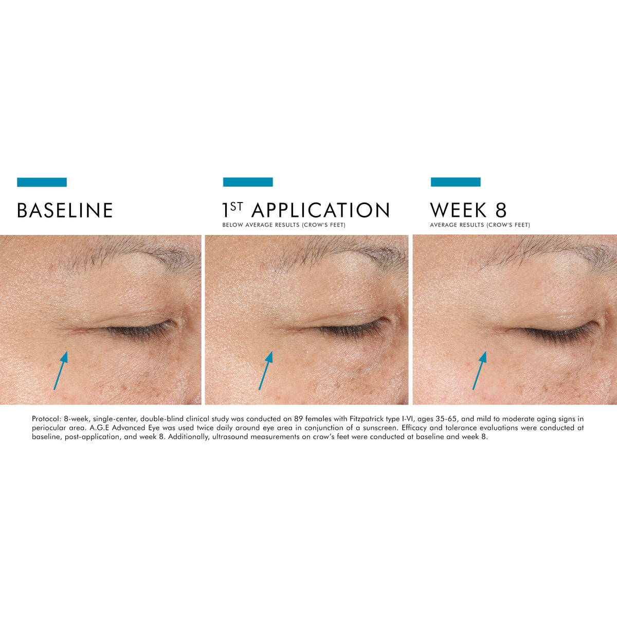 SkinCeuticals A.G.E. Advanced Eye – MD Skin Lab Canada