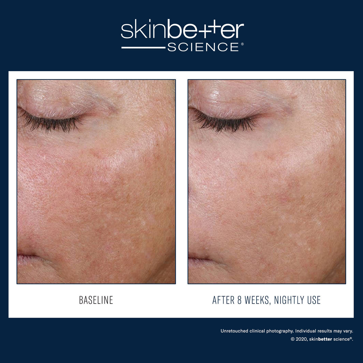 SkinBetter Science AlphaRet Overnight Cream – MD Skin Lab Canada